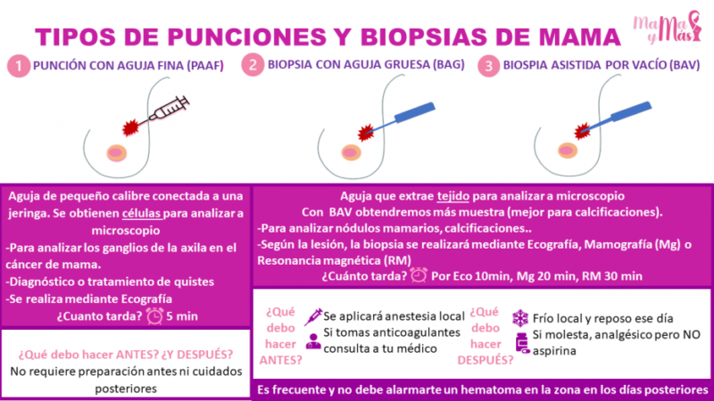 Biopsia mamaria guiada por imagen en Madrid - Mamografía Rosario